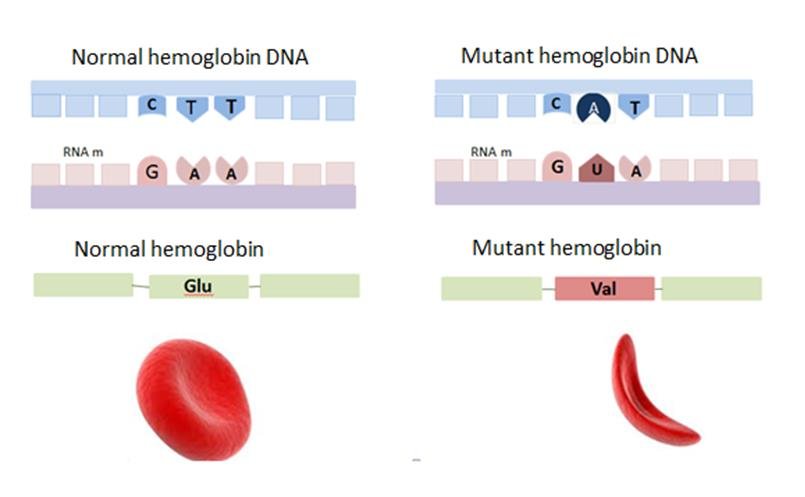 Bệnh hemoglobin (Hb) H kết hợp với đặc điểm hồng cầu hình liềm - NGUYỄN ...